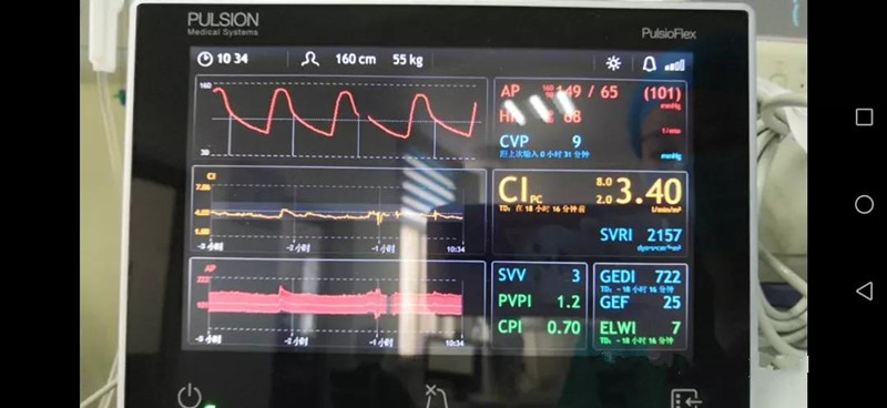 驻马店市中医院重症医学科成功开展首例PICCO监测新技术-医药卫生网-医药卫生报-河南省卫生健康委员会主管